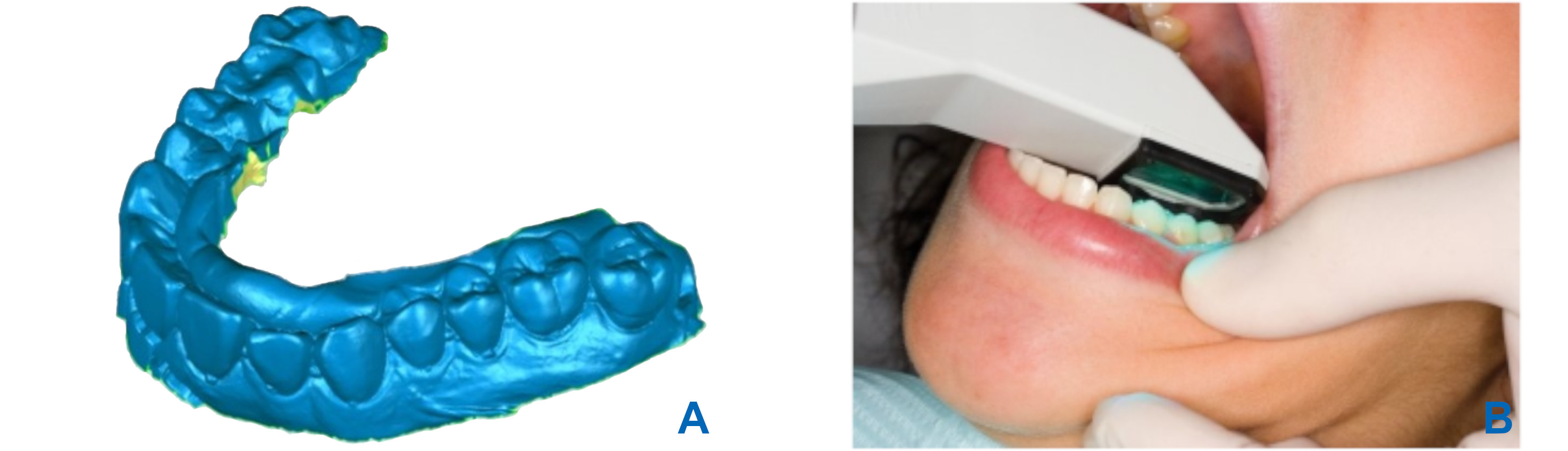 Digital impression - Dental Engineering Research Group - EHU